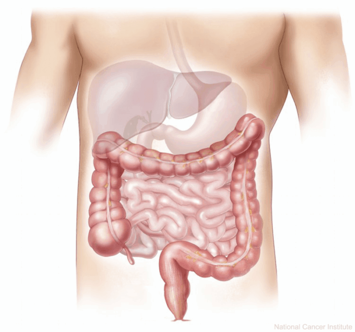 What is Intestinal Disorders? - elifesavingmedicine